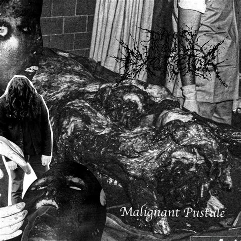 Malignant Pustule Demo 2025 Pus Excretor