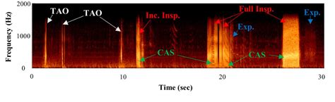 Figure 1 From A Dual Purpose Deep Learning Model For Auscultated Lung And Tracheal Sound