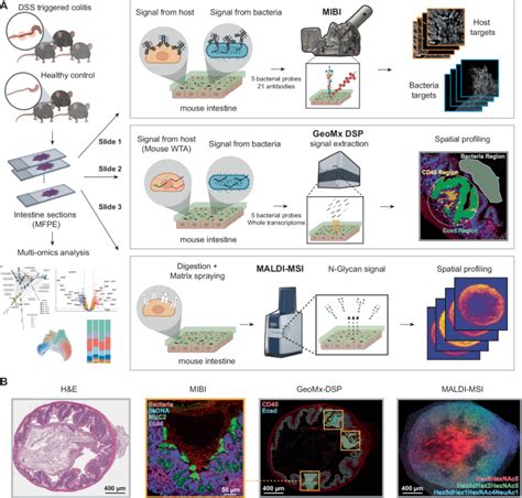 A Multi Omics Spatial Framework For Host Microbiome Dissection Within