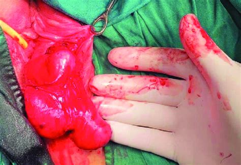 Dissection Of The Tumor Formation Download Scientific Diagram