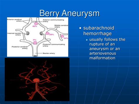 Ppt Cvd Stroke Septemius A Pansacola Rnmd Powerpoint Presentation