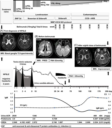 Belimumab Shows Promise In Neuropsychiatric Lupus Another Challenge To