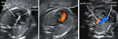 Ultrasound Atlas Glowm