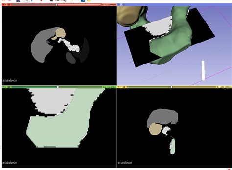 Interpolating Points Outside Image Support 3d Slicer Community