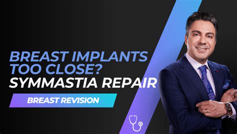 Symmastia Repair Restoring Natural Cleavage After Implant Malposition
