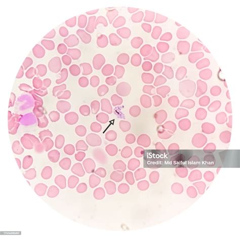 Plasmodium Vivax In Thin Film Under Microscopy Malaria Disease P Vivax Malaria Parasite In Red