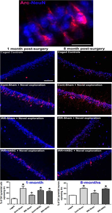 Representative Fluorescent Micrographs Of Arc Protein Expression Red Download Scientific