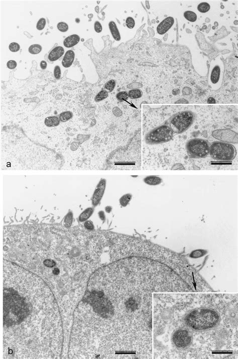 Transmission Electron Micrographs Of Hela Cells Infected With E Coli