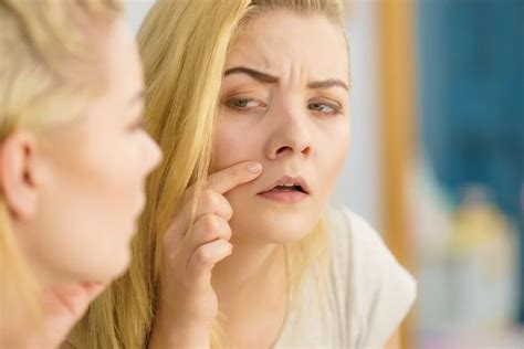 15 Common Skin Problems And How To Address Them — Sokörpe