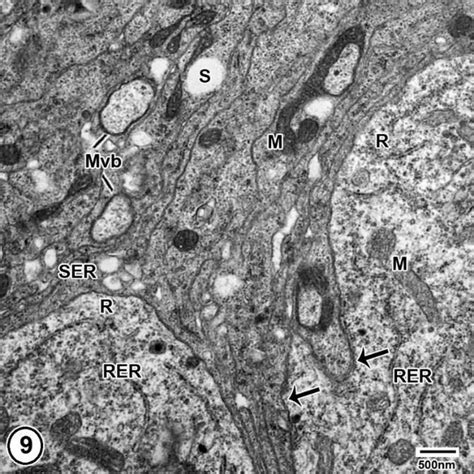 Fig B B7 B10 Electron Micrographs Of Control Corpus Allatum Of 6 Th Download Scientific