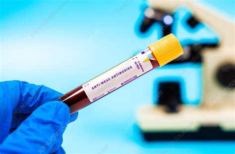 Anti Mda5 Antibodies Blood Test Stock Image F0442201 Science