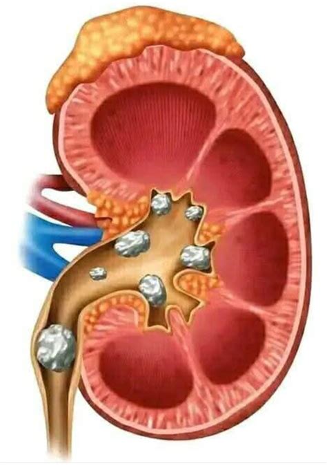 Aboubakr ⚠️ 10 عادات تدمر الكلى احذرها ⚠️ 1 عدم شرب كمية كافية من الماء 🥤 2 الإفراط في