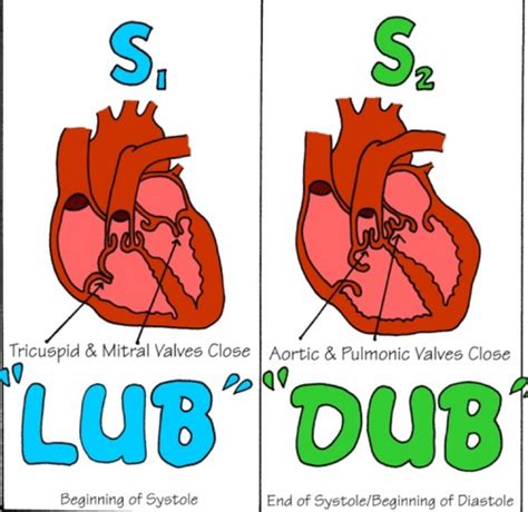 Unit 1 Rheumatic Fever Rhd And Infective Endocarditis Flashcards Quizlet
