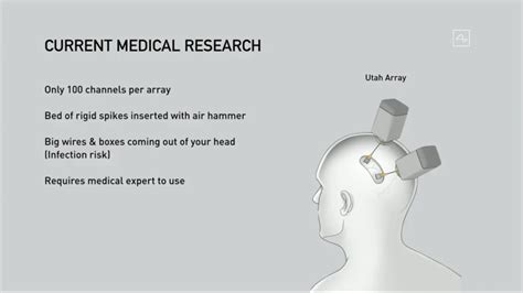 Neuralink Progress Update Summer 2020 Summary Rneuralink