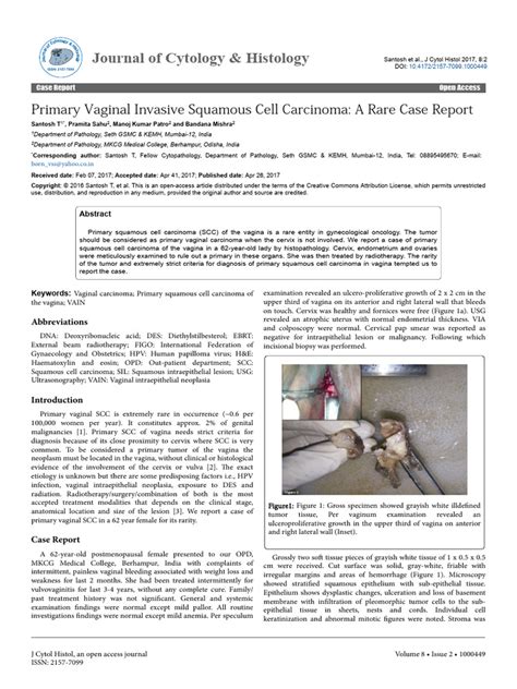 Primary Vaginal Invasive Squamous Cell Carcinoma A Rare Case Report 2157 7099 1000449 Pdf