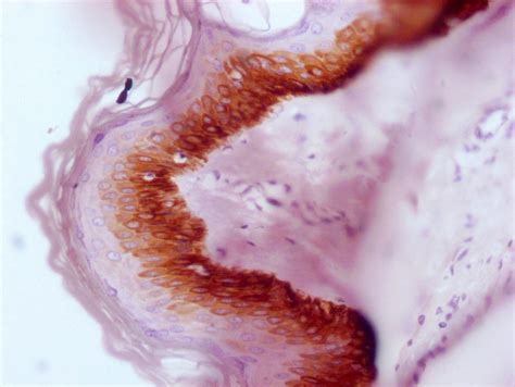 Anti Homo Sapiens Human Krt14 Monoclonal Antibody Raised In Mouse