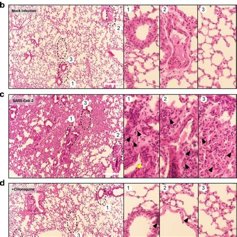 Inhibitors Of Endosomal Acidification Improved The Viability Of Vero E6