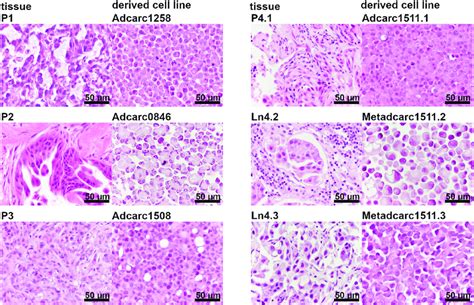 Formalin Fixed And He Stained Pac Tissue Samples And Cell Pellets