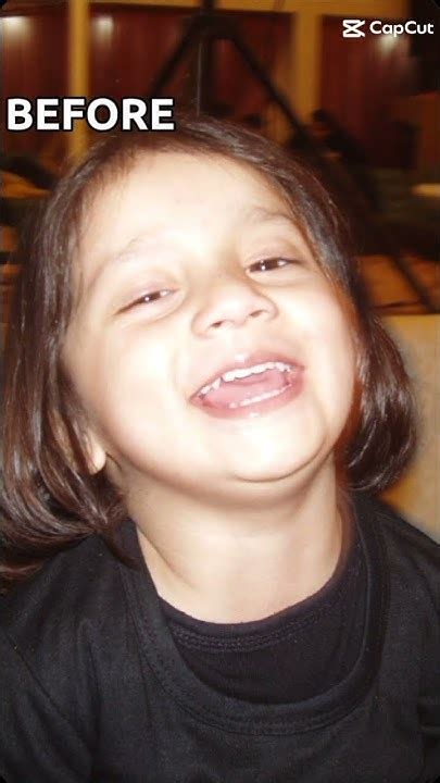 Before And After Chilhood Youtube