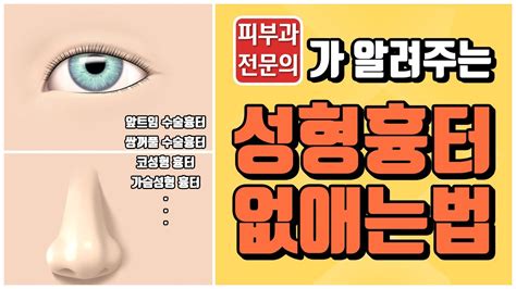 쌍꺼풀 앞트임 코성형 수술후 생긴 흉터 없애는법은 Youtube