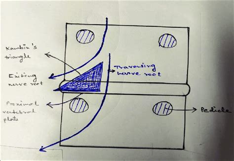 Anatomy Of Ostiomeatal Complex Epomedicine