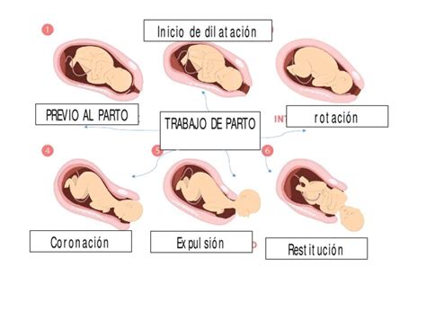 Trabajo De Parto Pdf