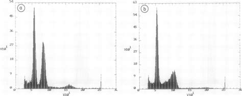 Dna Histograms A Triploid Partial Mole B Diploid Complete Mole