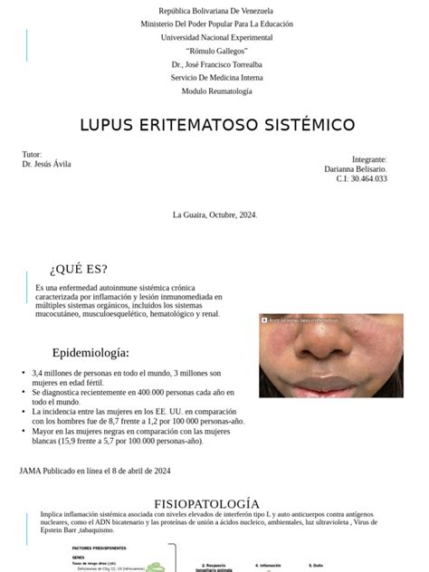 Lupus Eritematoso Sistémico Darianna Pdf Epidemiología Inmunología