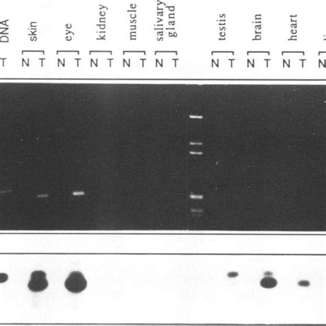 Detection Of Transgene Specific Transcripts Several Tissues Of Mice