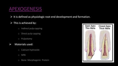 Ipcdpc Apexification And Apexogenesis With Recent Techniques