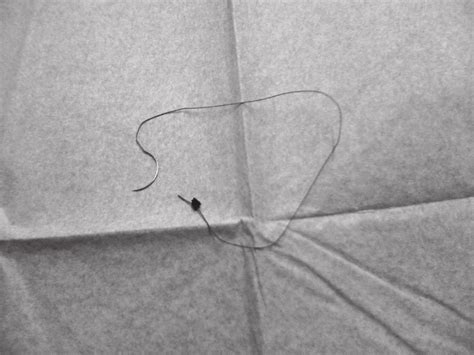 A Lapra Ty ® Clip Is Applied To The Suture Length Before Inserting Into Download Scientific