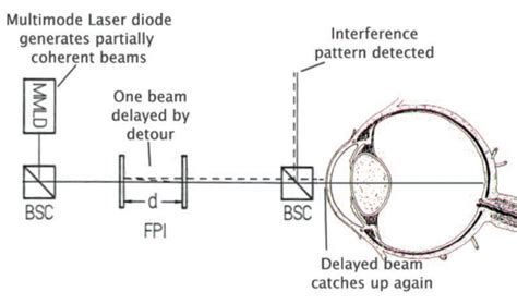 The Wonders Of Biometry For Ophthalmologists In London