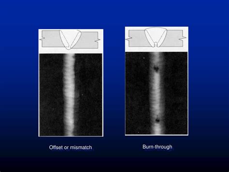 Ppt Radiography Test Powerpoint Presentation Free Download Id3624560