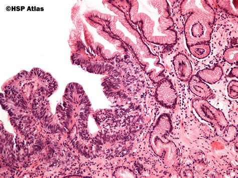 Hsp Atlas Histopathology Atlas Gi Tract