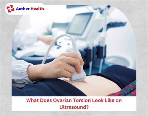 Ovarian Torsion Ultrasound Key Signs Findings And Diagnostic Accuracy