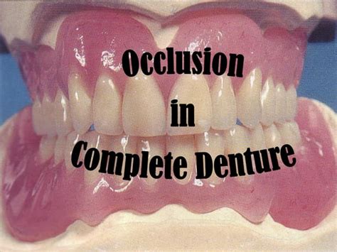 Occlusion In Complete Denture Basic Concept Pdf Occlusion In Complete Denture Basic Concept Pdf