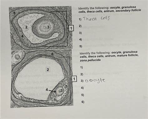 Solved Identify The Following Oocyte Granulosa Cells