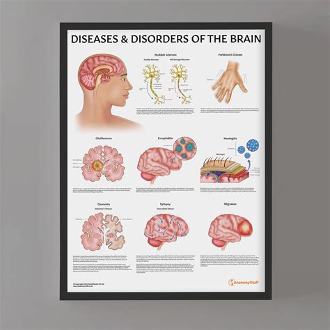 Diseases And Disorders Of The Brain Poster Brain Disorders Chart