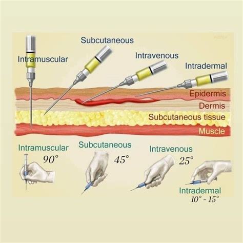 Pin By ⠀ On ㅤㅤㅤㅤㅤㅤㅤㅤㅤㅤ In 2025 Aesthetic Medicine Facial Aesthetics