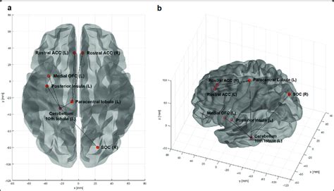 Network Based Statistics Results The Figure Shows The Sub Network With Download Scientific