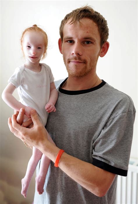 Oto najmniejsza pięciolatka świata FOTO