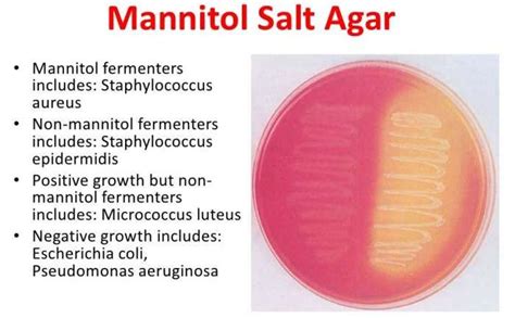 Mannitol Salt Agar Test