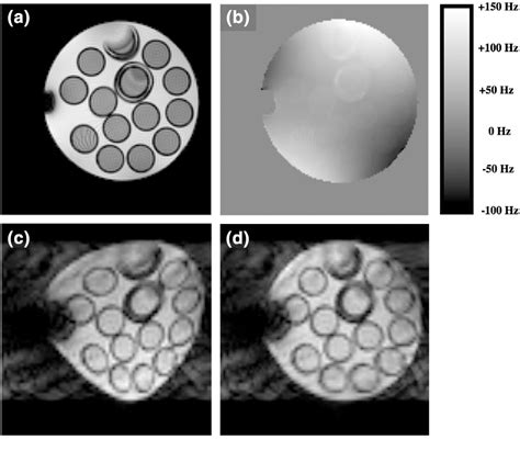 Figure 1 From Correction Of Geometric Distortion In Fmri Data Semantic Scholar