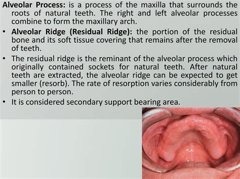 Alveolar Ridge Anatomy Alveolar Ridge Augmentation Blkxfs