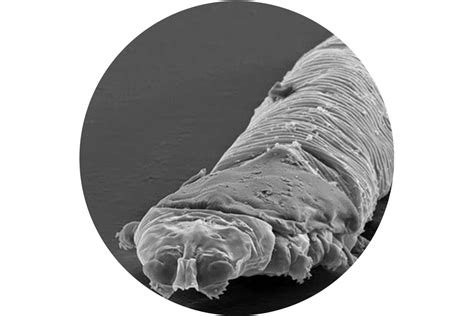 Nużeniec Kompendium Charakterystyka I Leczenie Demodekozy Nużyca Objawy Przyczyny Leczenie
