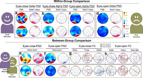 figure 4 from explainable deep learning prediction for brain computer interfaces supported lower