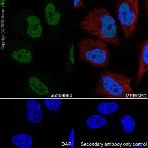 Anti Ythdc1 Antibody Epr21821 213 Ab259990 Abcam