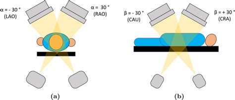 X Ray Source Angulations The Orbital Laorao And The Angular