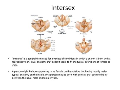 Intersex Anatomy