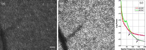 Bimorph Deformable Mirror Based Adaptive Optics Scanning Laser Ophthalmoscope For The Clinical
